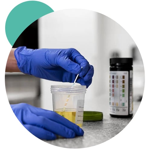 Urine Feses Test - Saline Bali