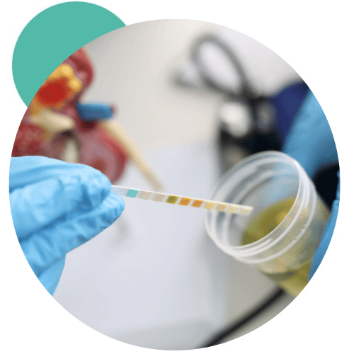 Urine and Feces Tests | Understanding For Your Health