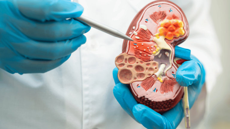 Kidney Function Test | Type Test In Saline Bali Clinic