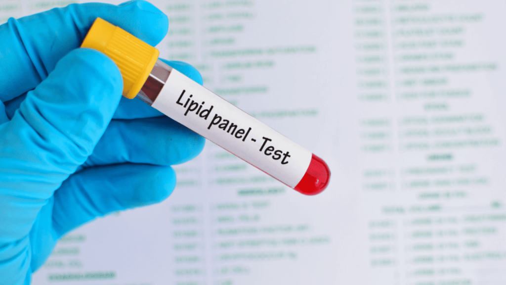 Lipid Profile Test | Find Benefits To Know Your Health