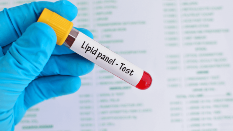 Lipid Profile Test | Find Benefits To Know Your Health